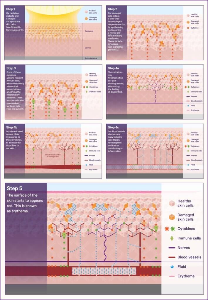 SCIENTIFIC COMMUNIQUÉ X: Photoprotection and the significance of ...