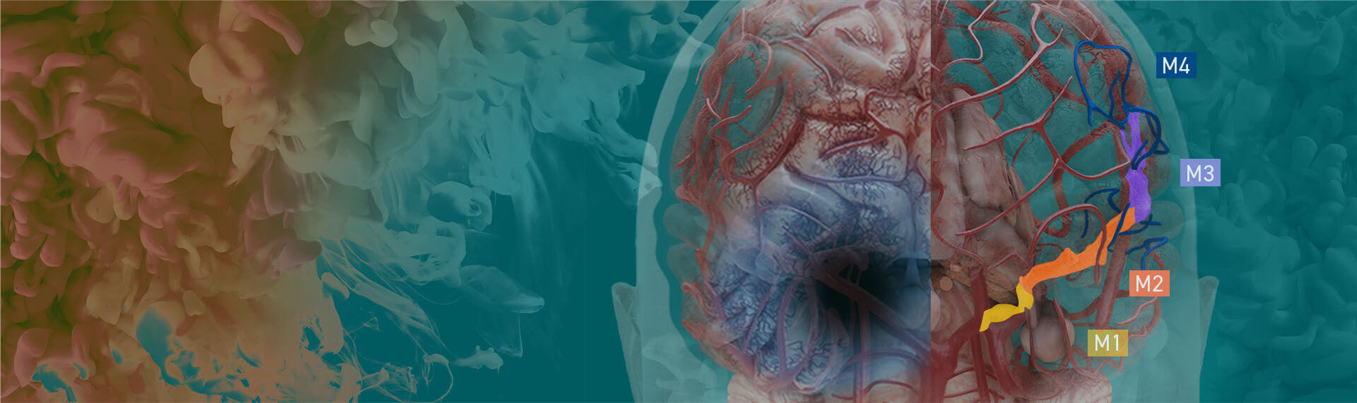 Technical note: Arterial Ischaemic Stroke (AIS) - CLINUVEL
